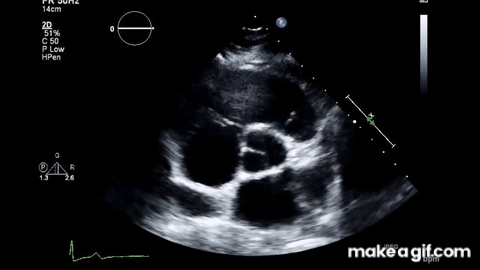 Normal Echo On Make A Gif