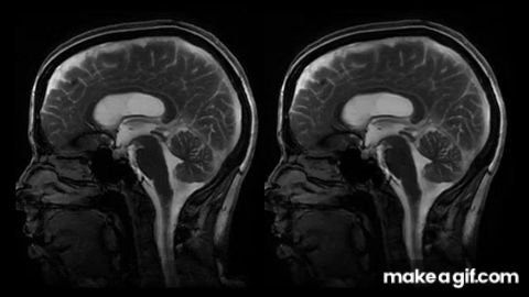 New MRI captures and magnifies the movement of the brain on Make a GIF
