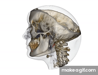 Soft Tissue & Bone - 3D Cone Beam CT Scan and Animation by SmartScan ...