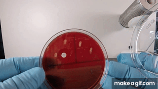 Streptococcus pyogenes on Blood Agar with a Taxo A Disc on Make a GIF