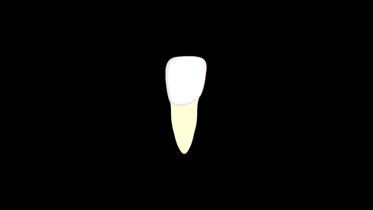 First Aid Management of An Avulsed Tooth (English version) on Make a GIF