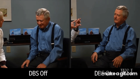 Deep Brain Stimulation: How It Works on Make a GIF