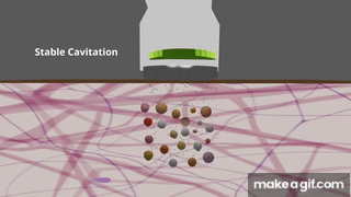 Introduction to Therapeutic Ultrasound on Make a GIF