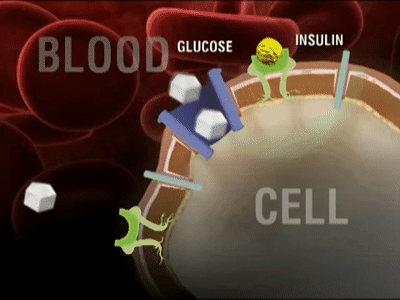 What is Type 1 Diabetes? on Make a GIF