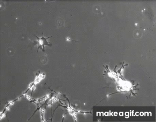 Brain cells in a culture dish trying to form connections with each ...