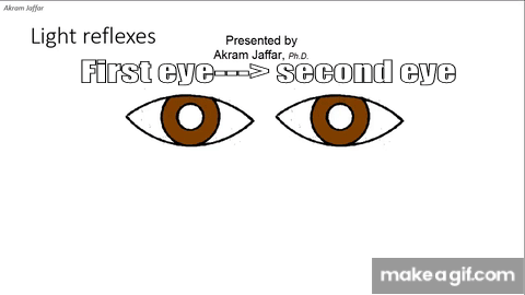 Anatomy of the light reflexes on Make a GIF