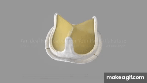Edwards INSPIRIS RESILIA Aortic Valve on Make a GIF
