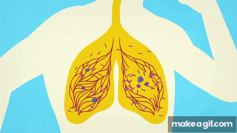 What makes tuberculosis (TB) the world's most infectious killer ...