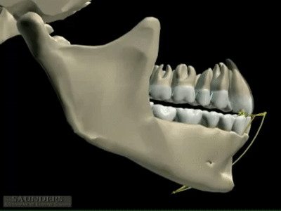 Mandibular Movement 3D Graphic Video on Make a GIF