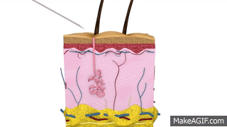 Injection Techniques on Make a GIF