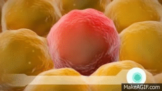 Cancer: Unregulated Cell Division on Make a GIF