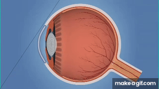 Aqueous Humor on Make a GIF