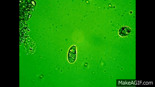 Several Different Microbes under microscope, Euglena, Rotifer, Amoeba ...