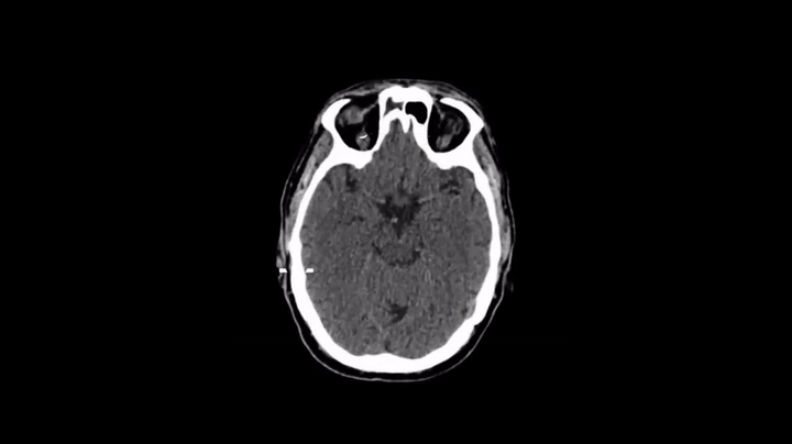 How to Read a CT Scan of the Head - MEDZCOOL on Make a GIF