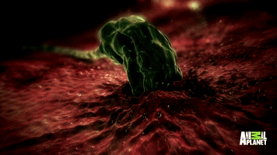 Leishmaniasis Creates Huge Open Wound on a Young Man's Face on Make a GIF