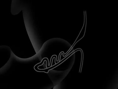 Rotation of the midgut on Make a GIF