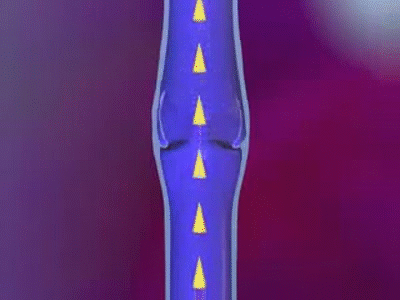 Les varices on Make a GIF