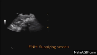 Role of Contrast Ultrasound and Elastography in Liver and Gallbladder ...