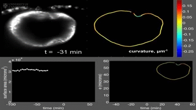 Volvox embryo turning itself inside out on Make a GIF