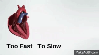 Understanding Arrhythmias on Make a GIF