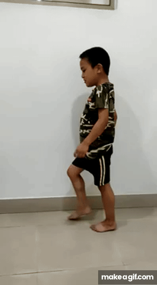 Muscular dystrophy posture gait due to gluteus muscle weakness on Make ...