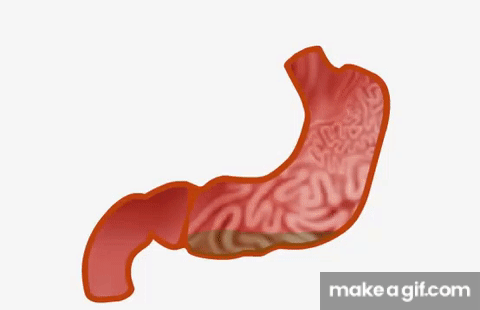 Stomach Motility on Make a GIF