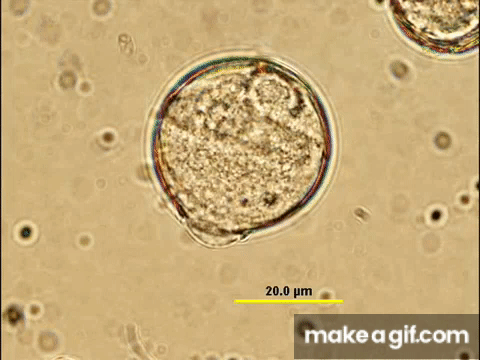Pollen Germination in vitro on Make a GIF