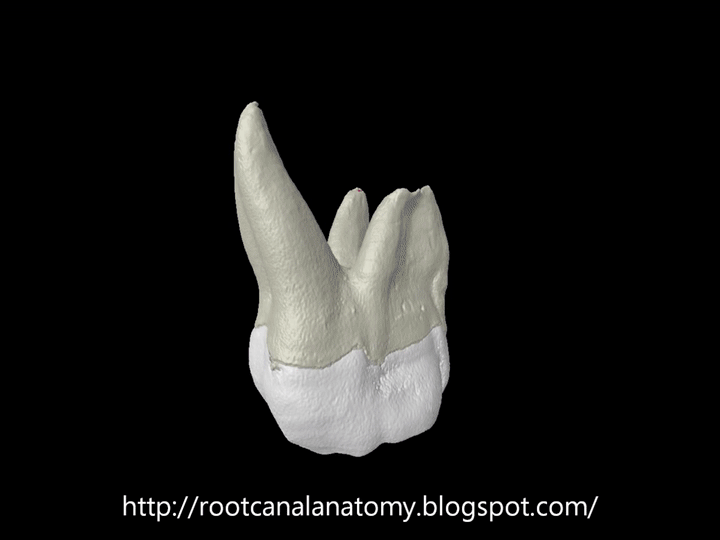 Maxillary First Molar (Five Canals) Prof Marco Versiani on Make a GIF