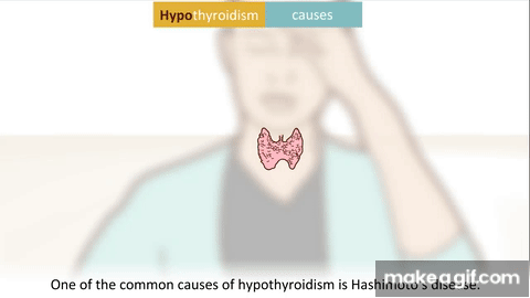 Thyroid problems - most common thyroid problems, symptoms and treatment ...