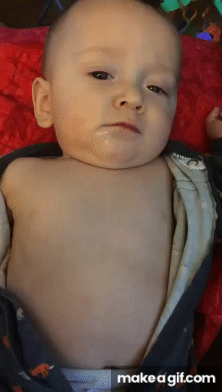 Nasal Flaring and Substernal/Subcostal Retractions in Infant on Make a GIF