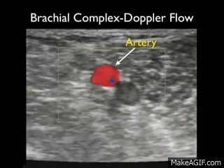 Peripheral Venous Access Under Ultrasound Guidance - Part 1 - SonoSite ...