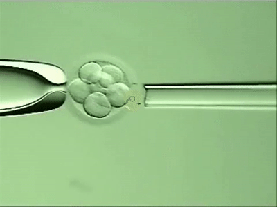 Embryo biopsy using acid or laser on Make a GIF