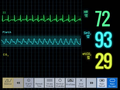 ECG Monitor Loop on Make a GIF