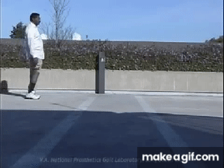 Knee Instability on Make a GIF