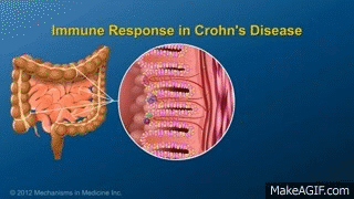 What is Crohn's Disease? on Make a GIF