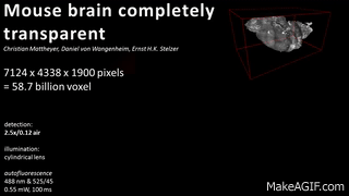 Mouse brain completely transparent on Make a GIF