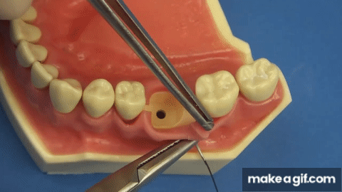 LEARN TO SUTURE THE EASY WAY ! Surgical Technique - Interrupted Buccal ...