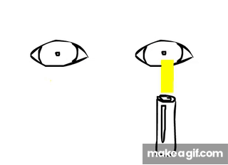 Relative Afferent Pupillary Defect/Marcus Gunn Pupil on Make a GIF