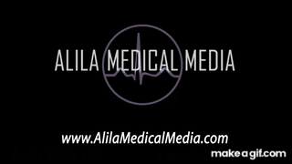 Wolff-Parkinson-White Syndrome Pathophysiology, Pre-Excitation and AVRT ...