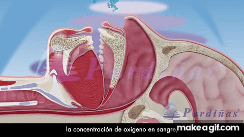 Apnea del sueño y Roncopatía © on Make a GIF