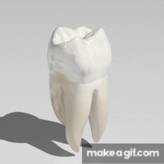 7 Segundo molar superior on Make a GIF