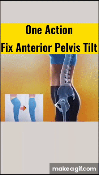 How to Fix Anterior Pelvic Tilt | Fitness Motivation #shorts # ...