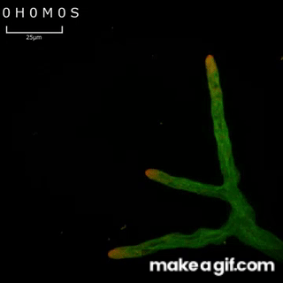 Fungus（Hyphal growth） on Make a GIF