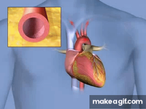 What is Shock? on Make a GIF